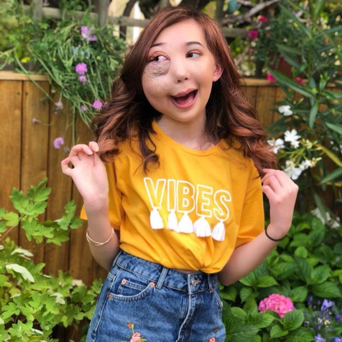 Embracing our differences with Nikki Lilly | Enable Magazine | Enable ...